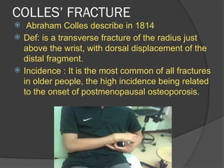 COLLES’ FRACTUREggggggggggggggggggggg.pptx