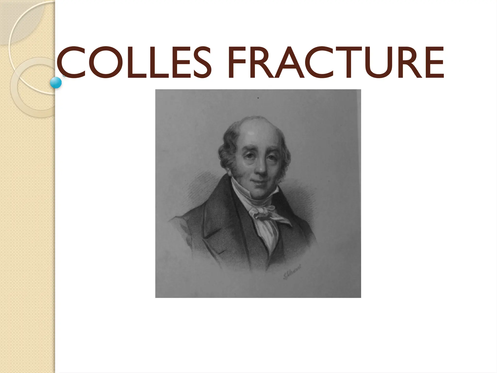 Colles fracture most common of all fractures | PPTX
