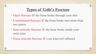 Colles fracture presentation | PPTX