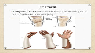 Colles fracture presentation | PPTX