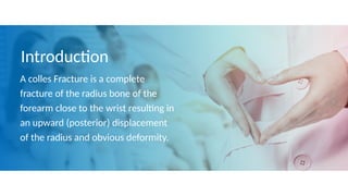 Colles fracture-WPS Office.pptx presentation | PPT