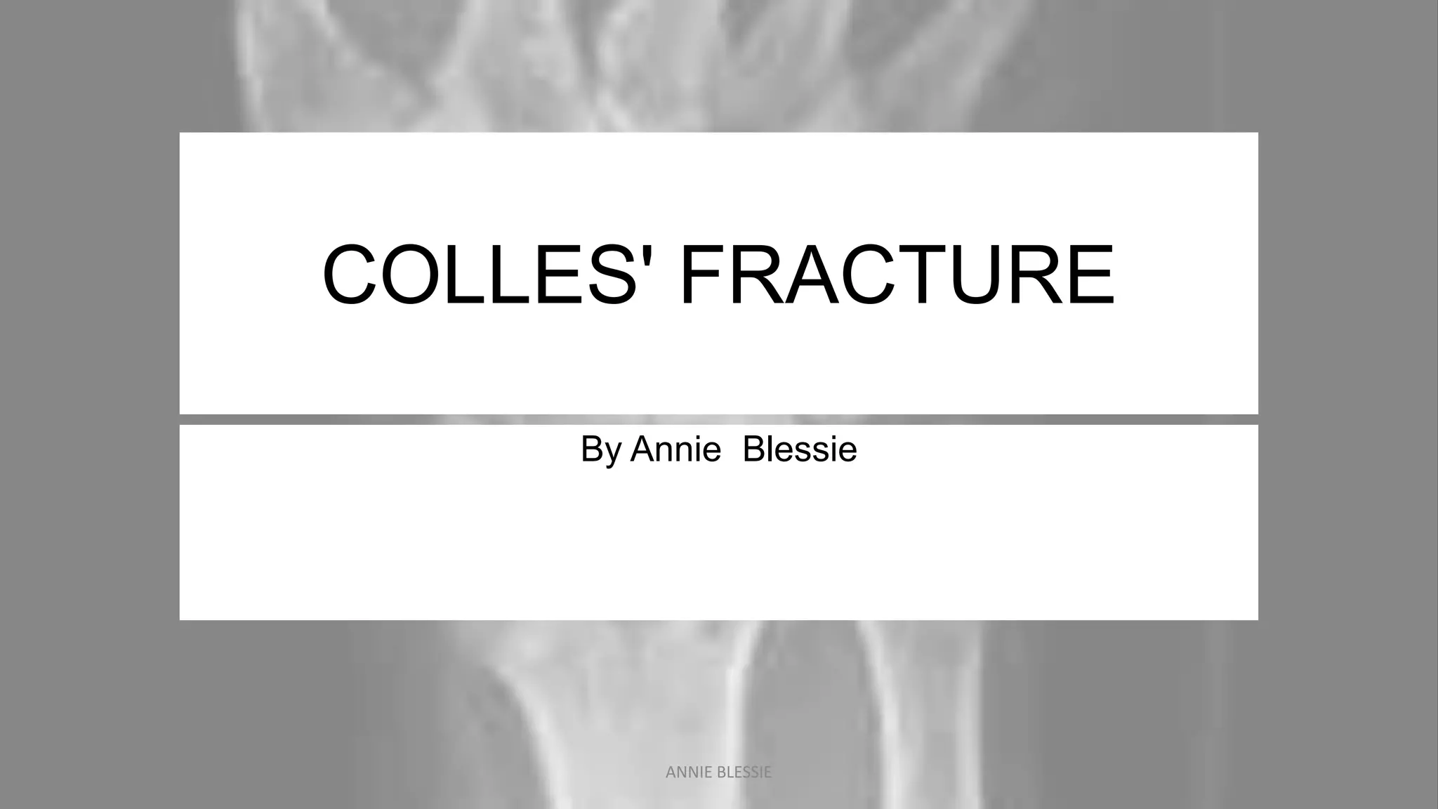 Colles' fracture & physiotherapy management | PPTX