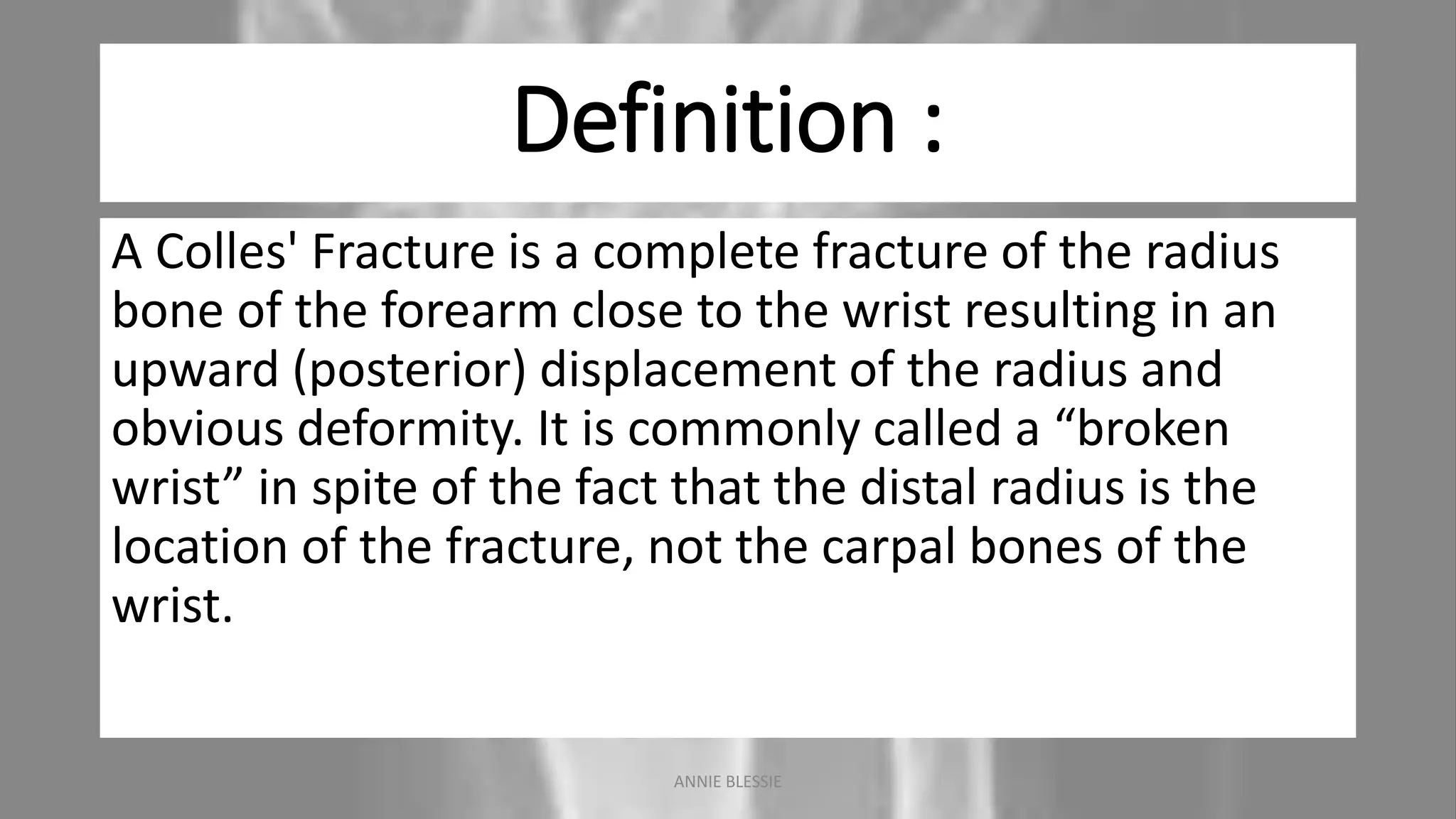 Colles' fracture & physiotherapy management | PPTX