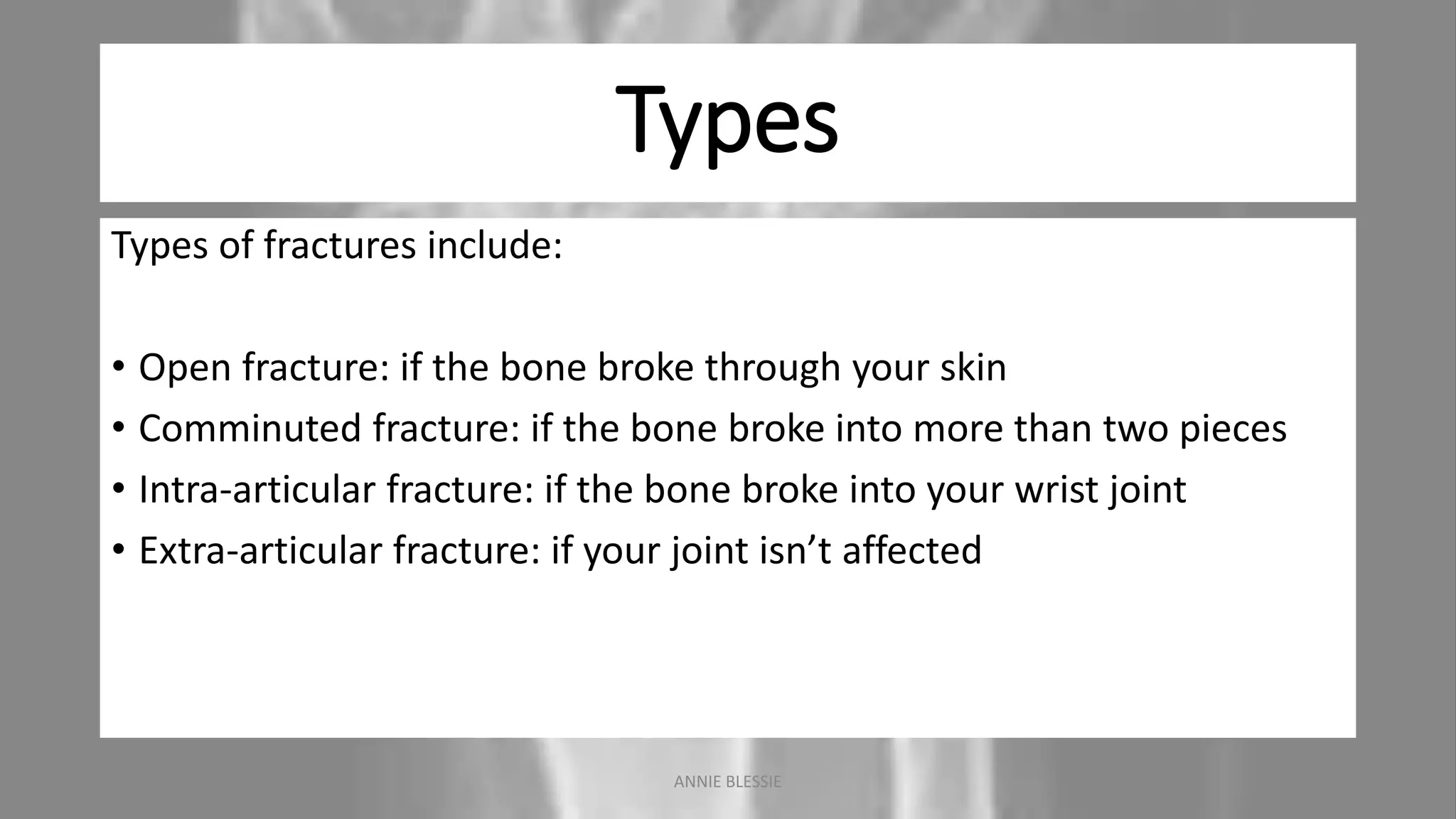 Colles' fracture & physiotherapy management | PPTX