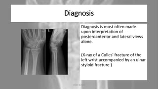 Colles' fracture & physiotherapy management | PPTX