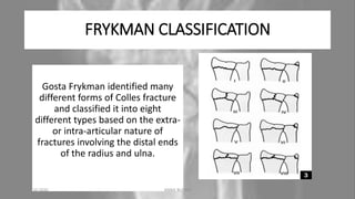 Colles' fracture & physiotherapy management | PPTX