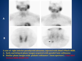 Gamma camera Collimators used in Nuclear Medicine.pptx