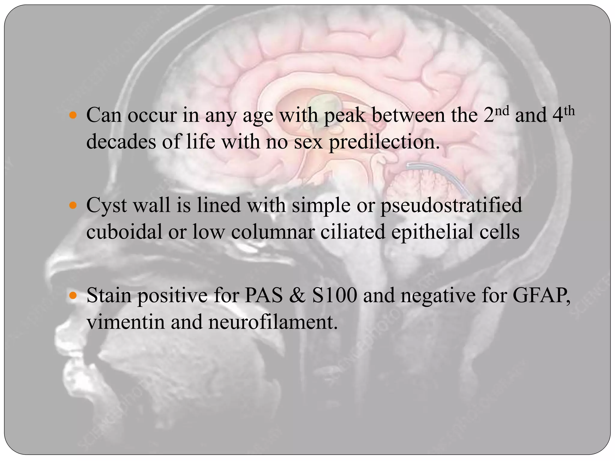 Colloid cyst | PPTX