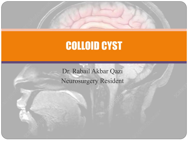 Colloid cyst | PPTX | Brain and Nervous System Disorders | Diseases and ...