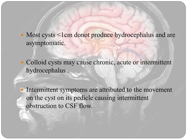 Colloid cyst | PPTX | Brain and Nervous System Disorders | Diseases and ...