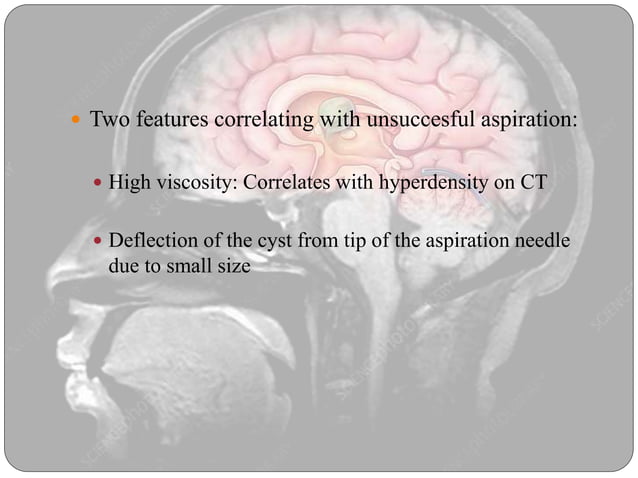 Colloid cyst | PPTX | Brain and Nervous System Disorders | Diseases and ...