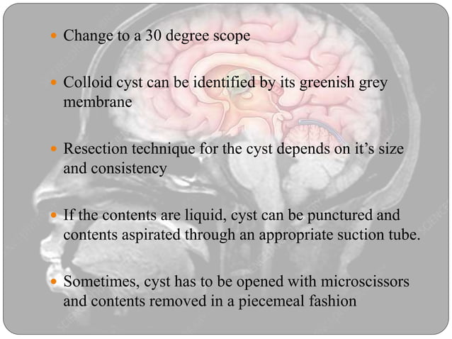 Colloid cyst | PPTX | Brain and Nervous System Disorders | Diseases and ...