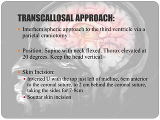 Colloid cyst | PPTX