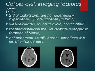 Symptomatical colloid cyst_Torfs | PPT
