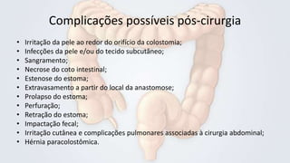 Colostomia | PPTX