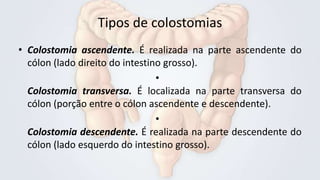 Colostomia | PPTX
