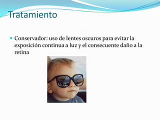 Coloboma congenito y desarrollo embriologico del ojo | PPTX
