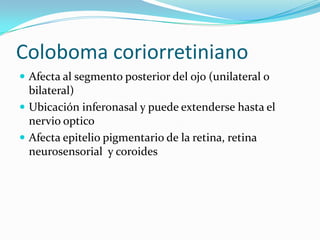 Coloboma congenito y desarrollo embriologico del ojo | PPTX