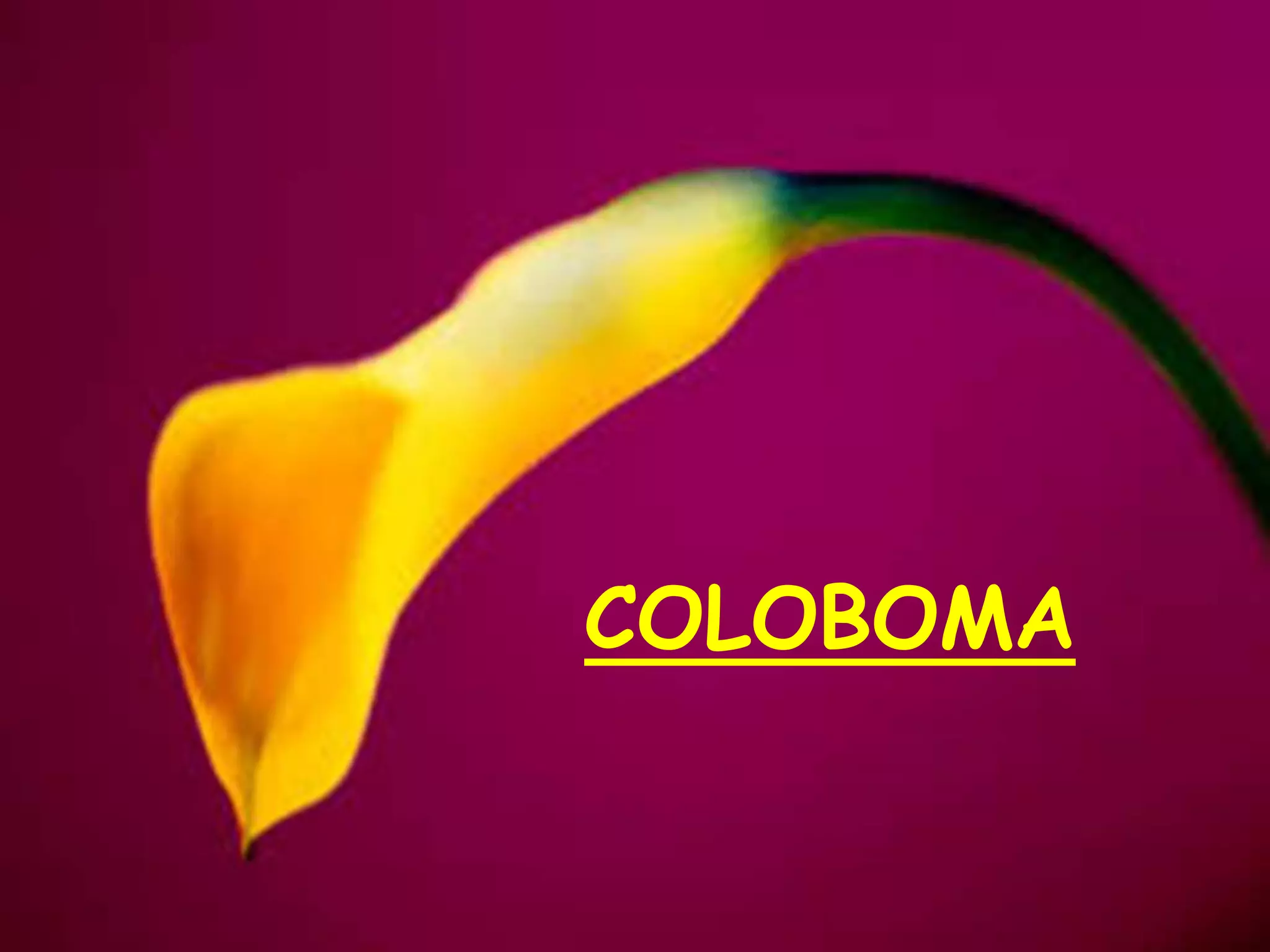 Coloboma | PPTX