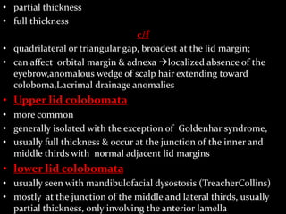 Coloboma | PPTX