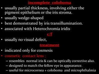 Coloboma | PPTX