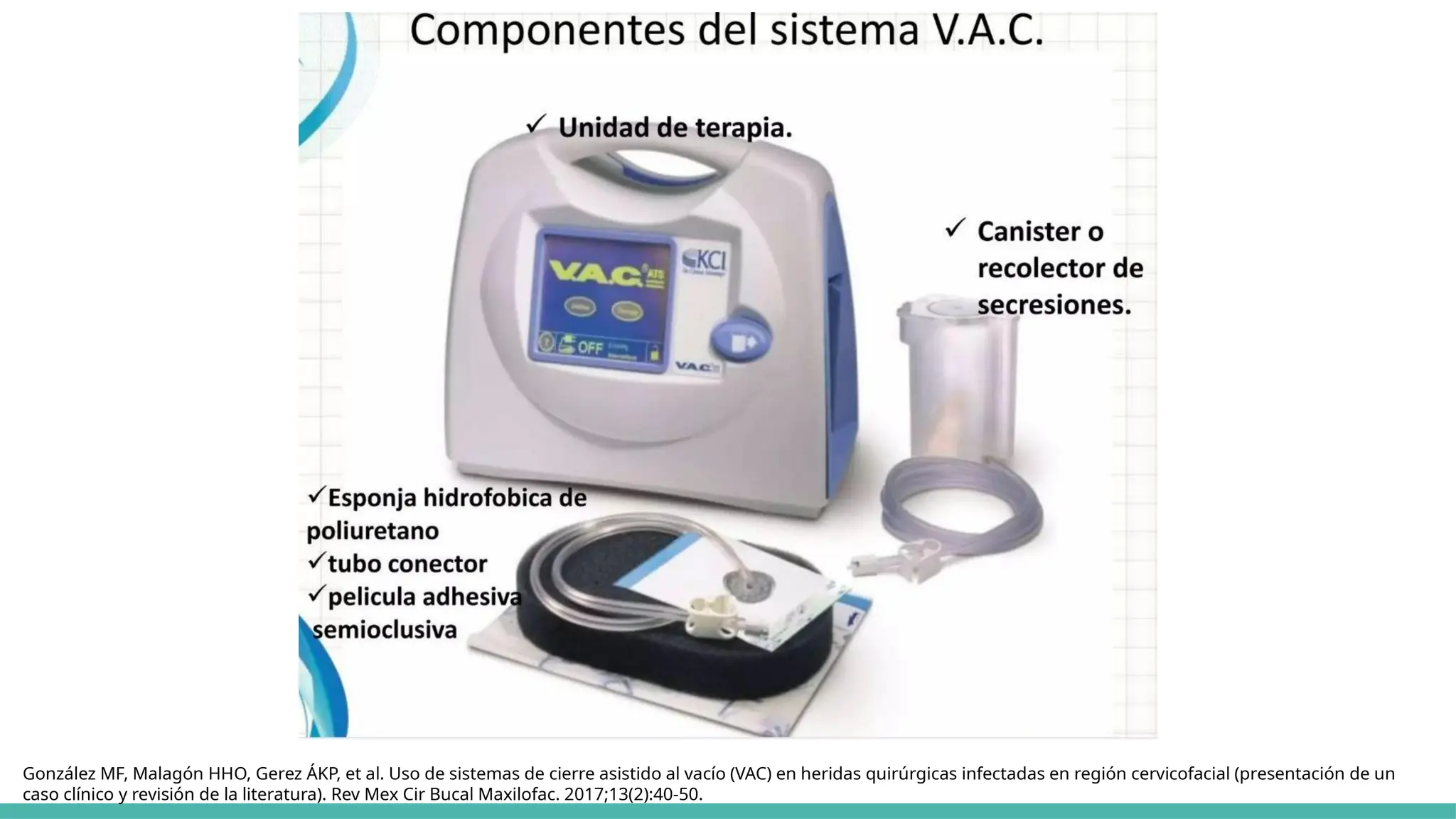 Colocación de Cierre Asistido por Vacío (VAC).pptx