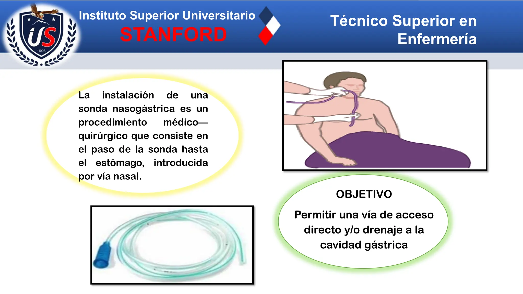 Colocación de la sonda nasogastrica .pdf
