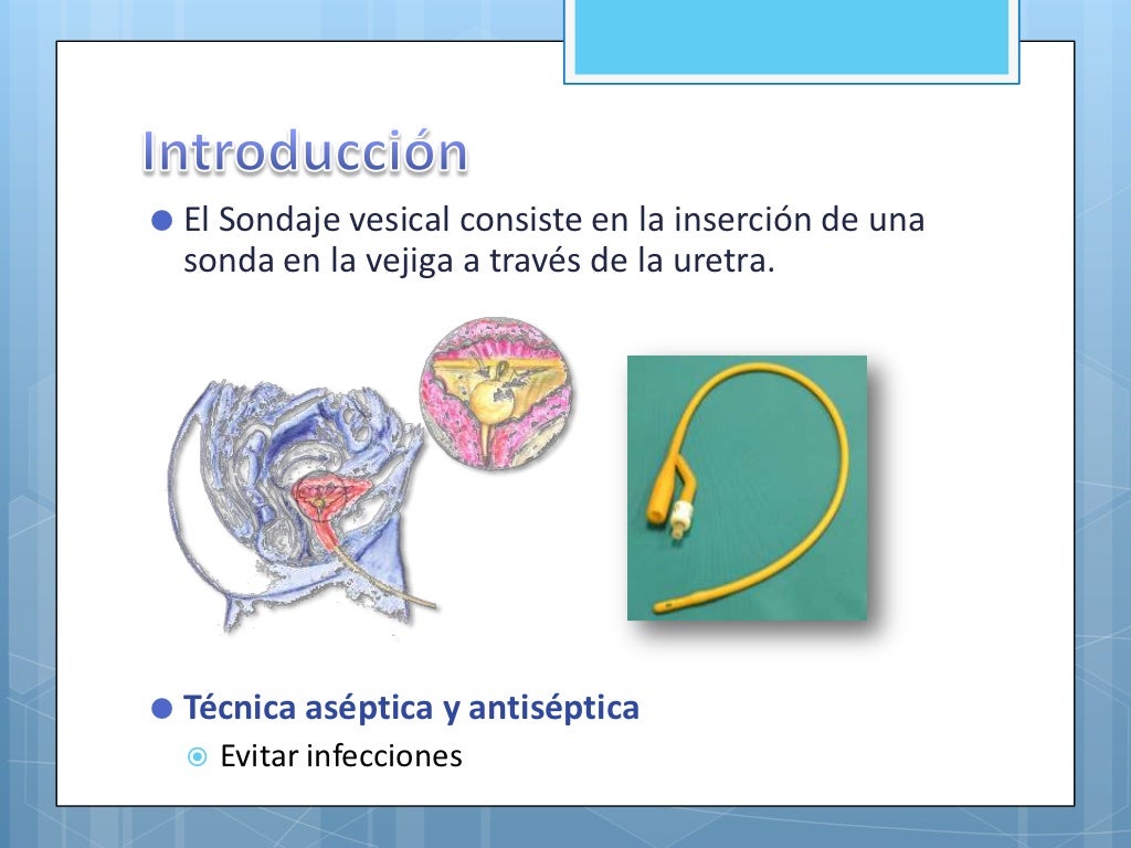 Colocación de sonda foley