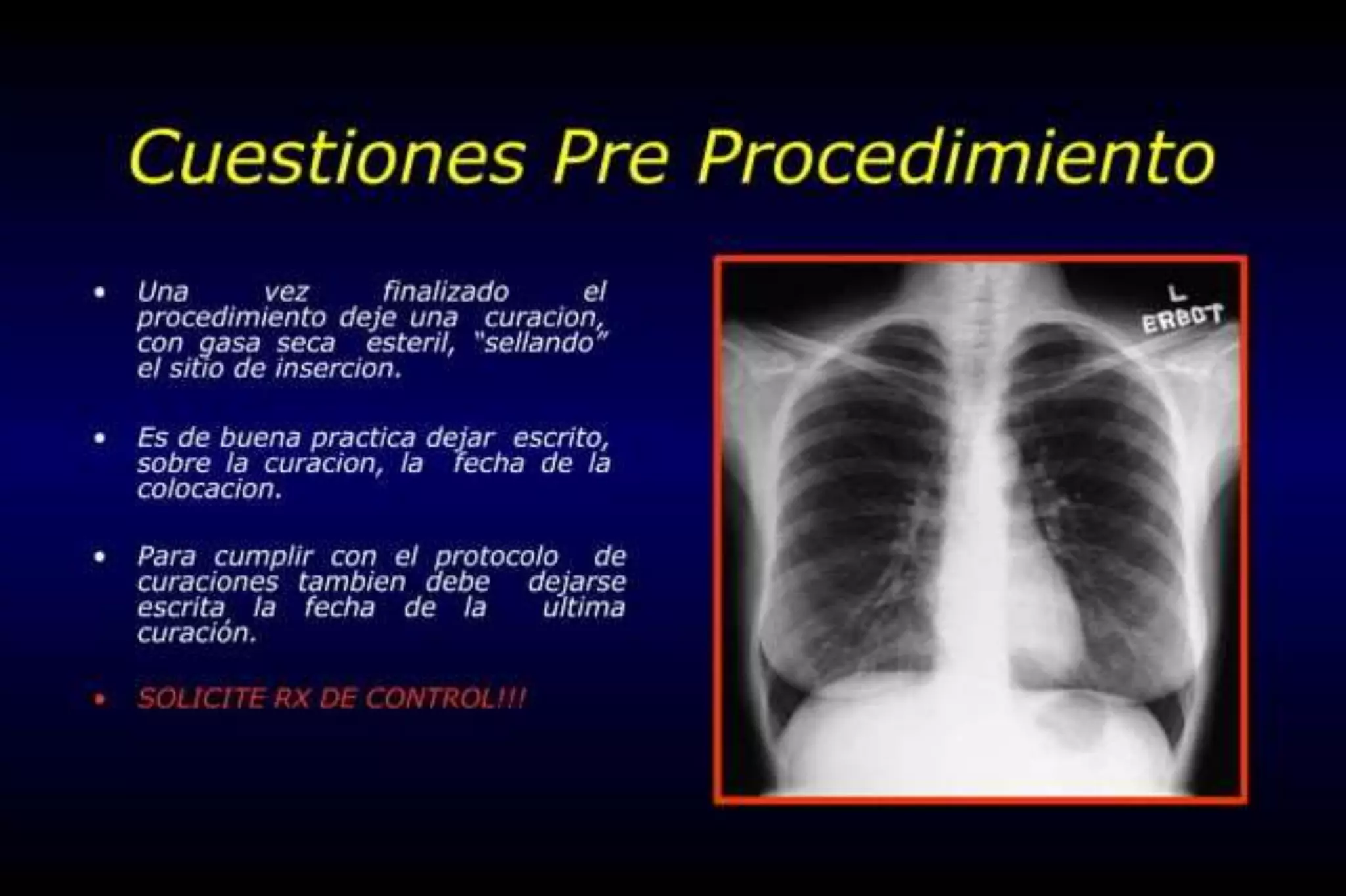 COLOCACION DE CVC.pptx