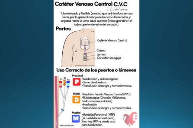 COLOCACION DE CVC.pptx