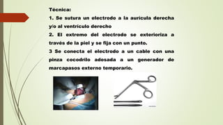 Colocacion De Marcapasos Pptx