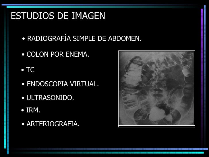 Radiología del Colon