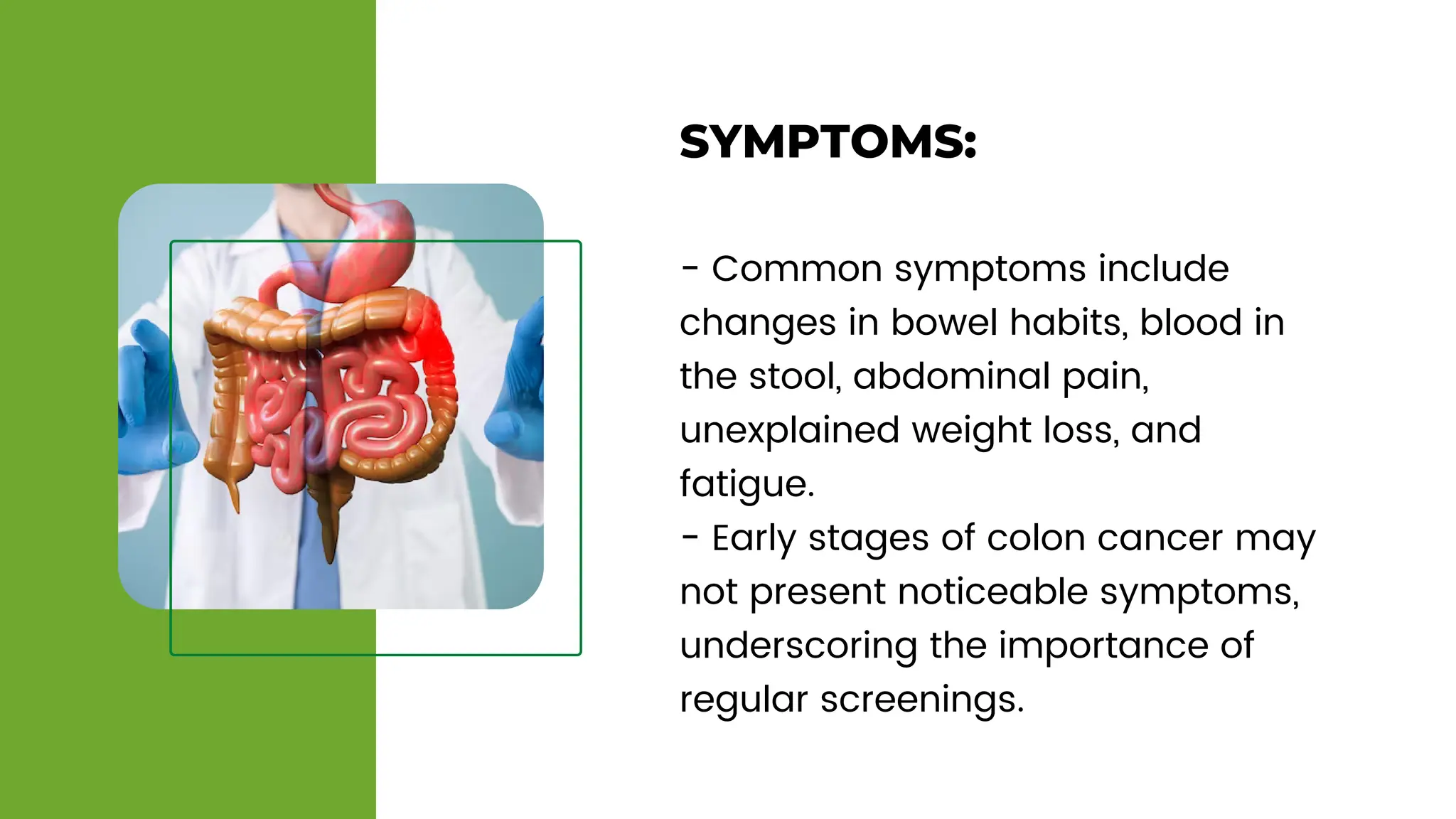 Colon Cancer PPT | PDF