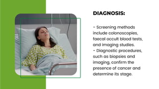 Colon Cancer PPT | PDF