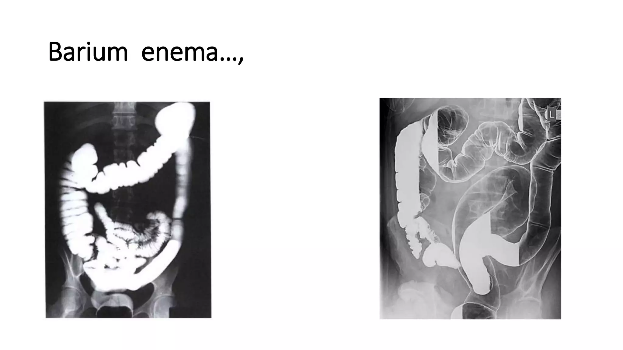 Colon anatomy | PPTX