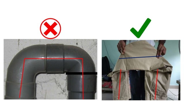 Colon anatomy | PPTX