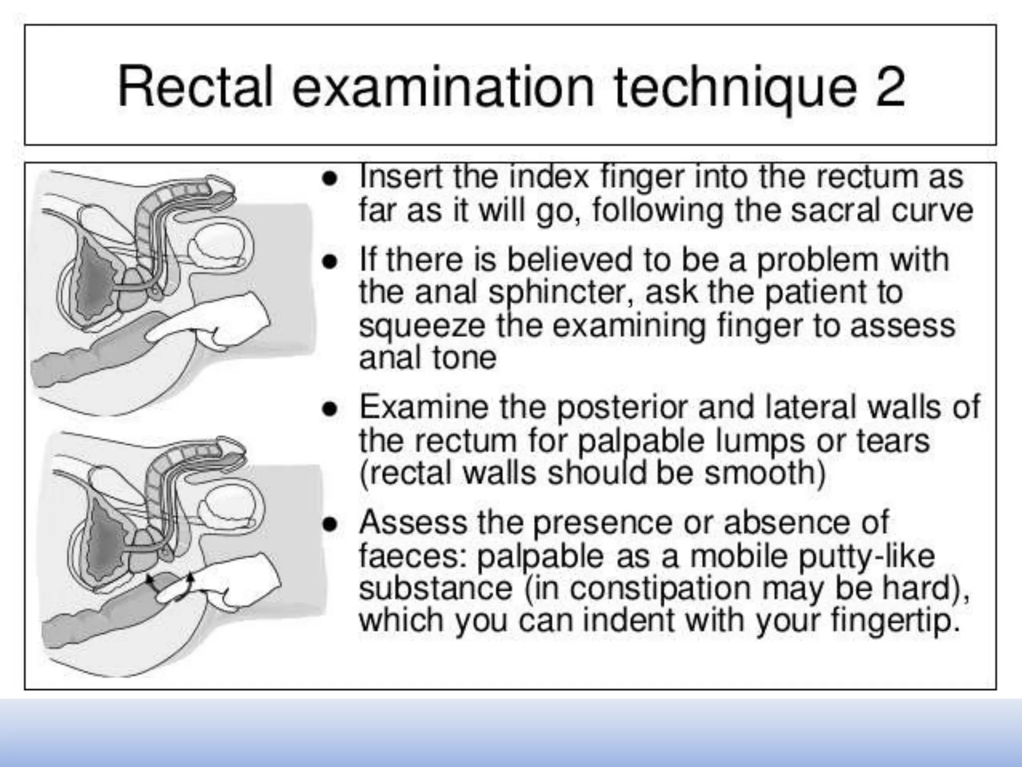 Colon and Rectum Surgical Anatomy and Physiology | PPTX