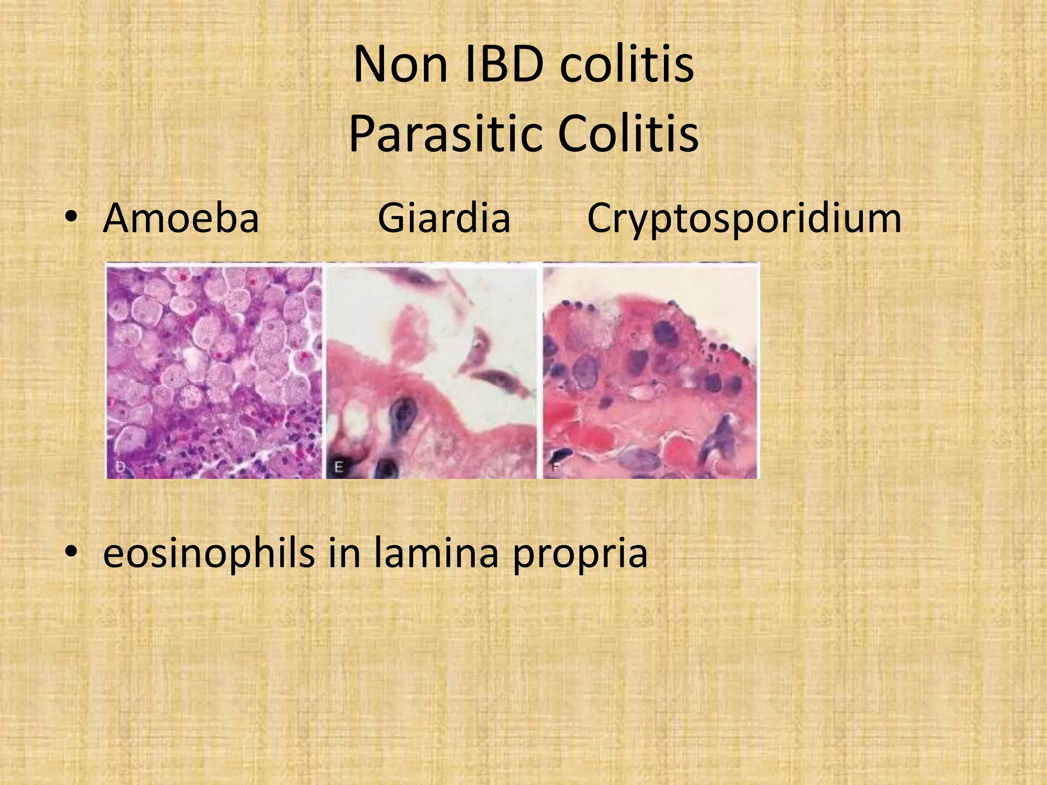 Colon biopsy naveen | PPT