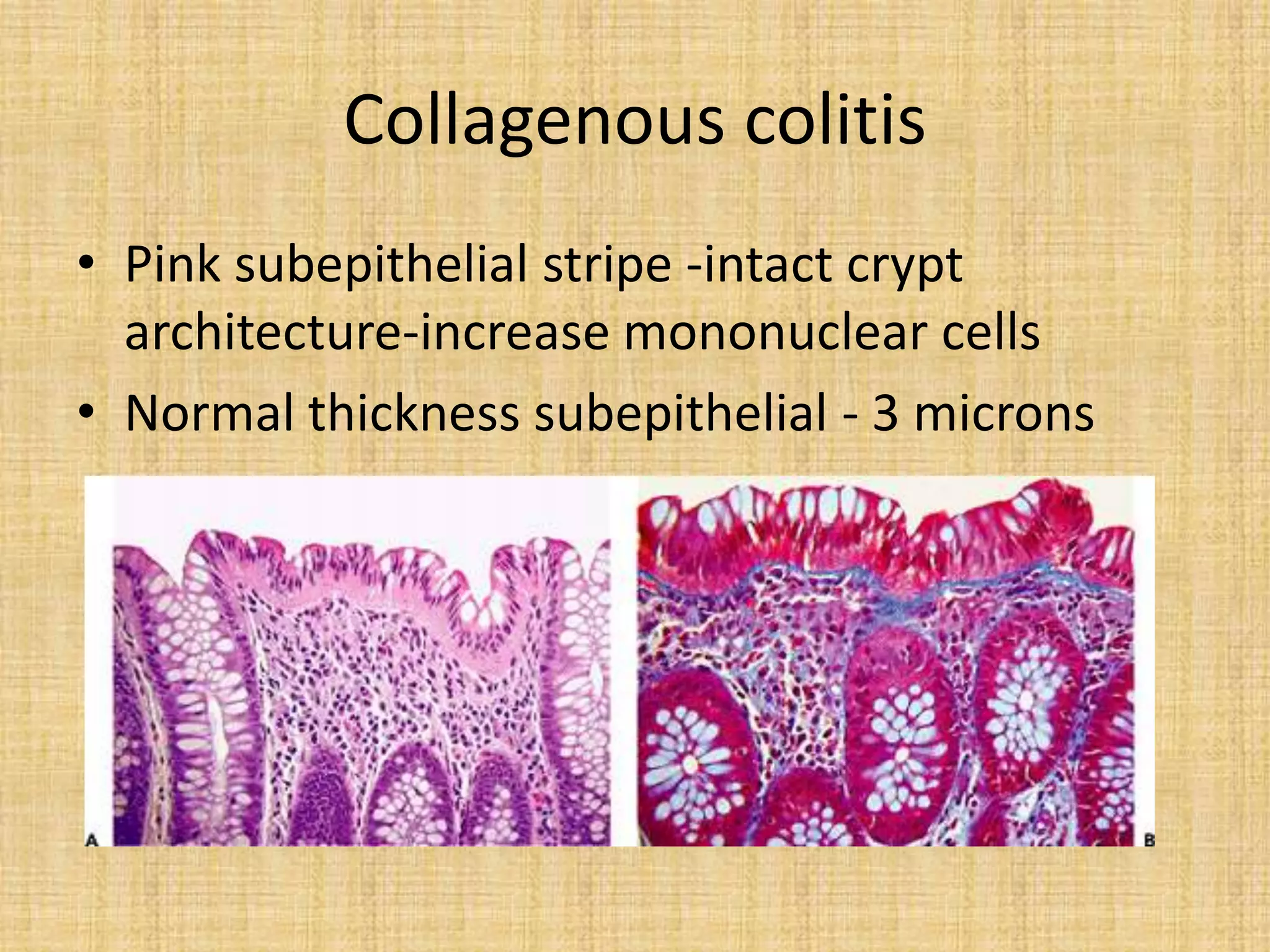 Colon biopsy naveen | PPT