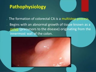 colon ca.pptx