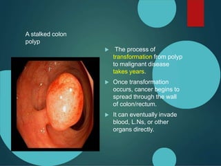 colon ca.pptx