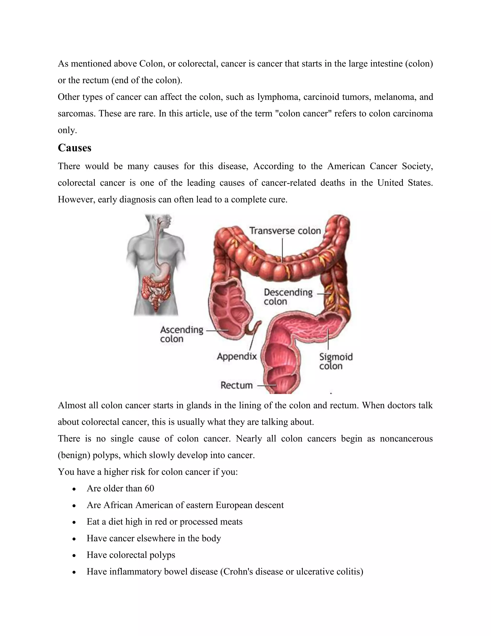 Colon cancer | DOCX