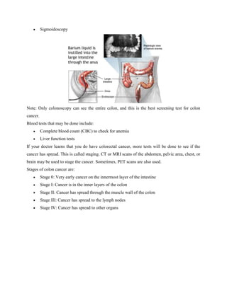 Colon cancer | DOCX