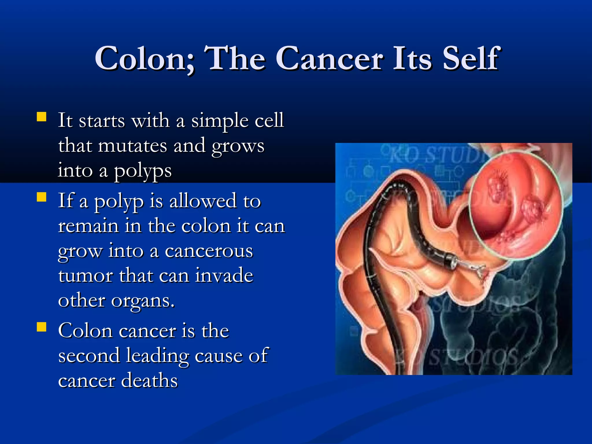 Coloncancer | PPT