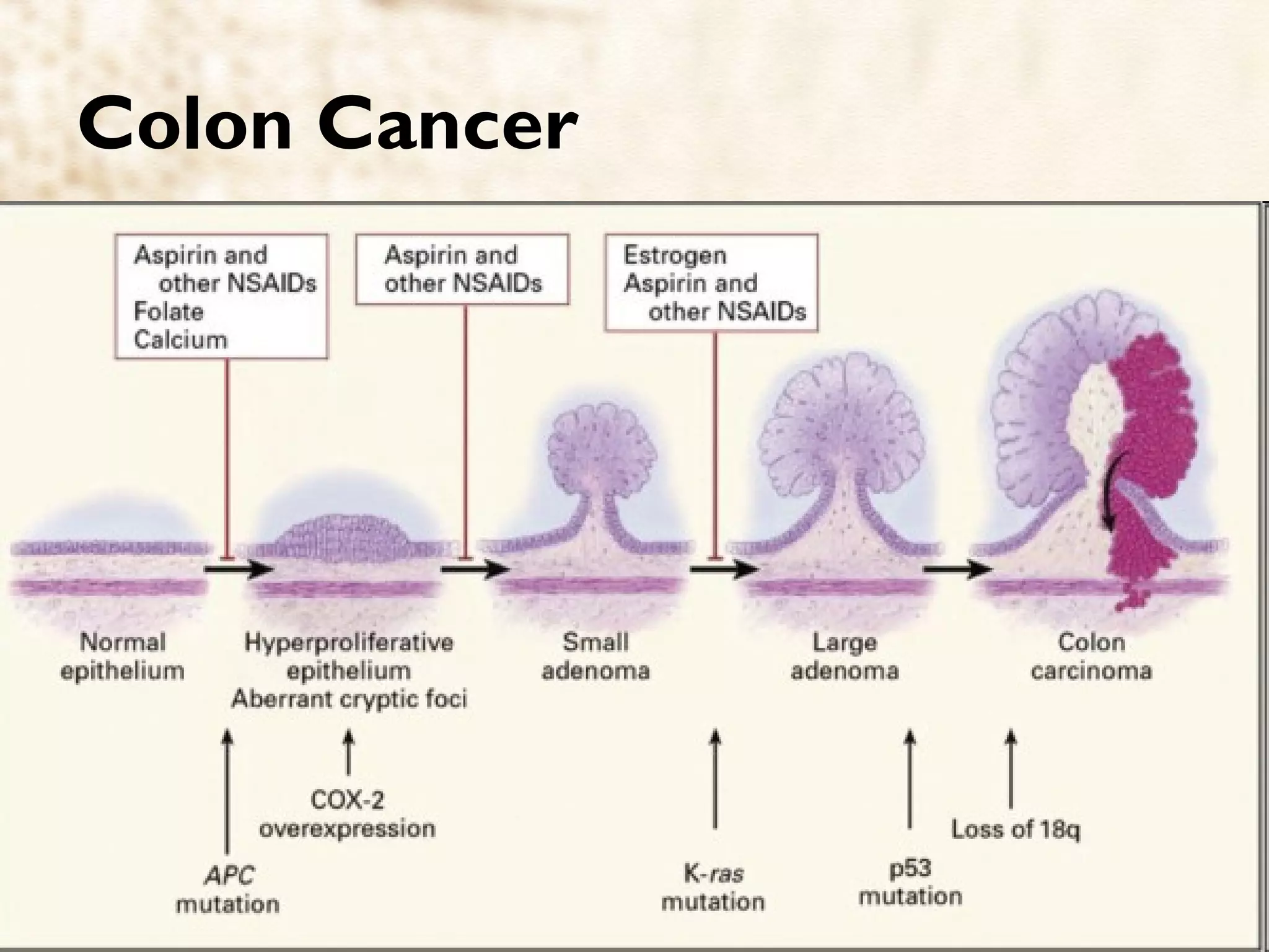 Colon cancer | PPT | Cancer | Diseases and Conditions