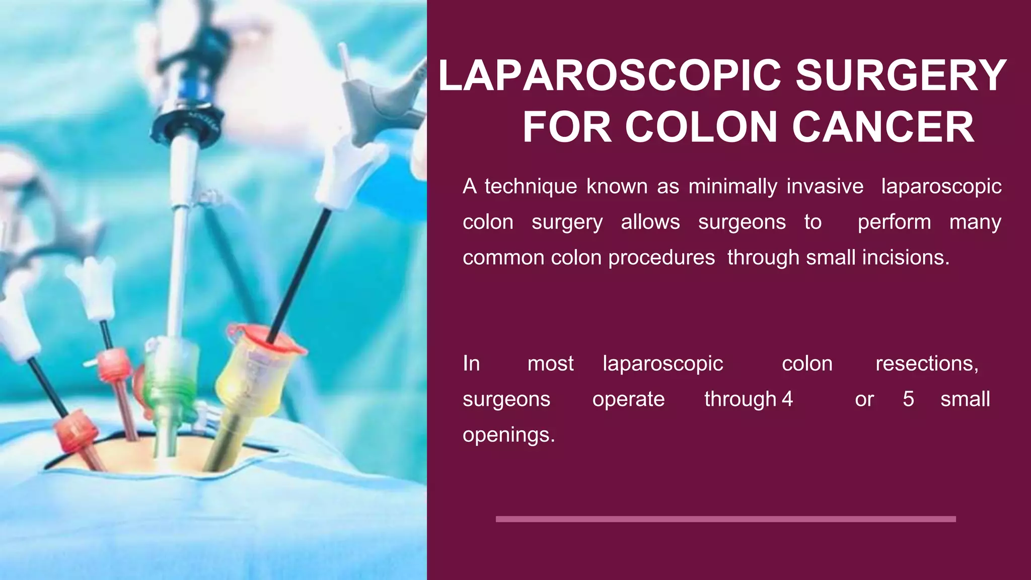 Coloncancer | PPT