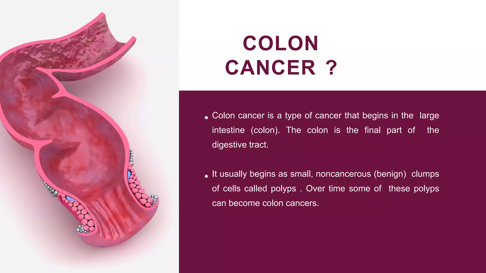 Coloncancer | PPT