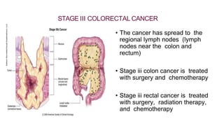 Coloncancer | PPT | Cancer | Diseases and Conditions