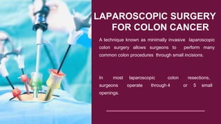 Coloncancer | PPT | Cancer | Diseases and Conditions