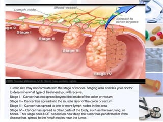 Colon Cancer in a Male Patient - Case Presentation | PPTX